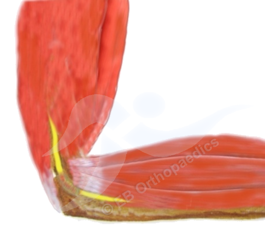 Orthopaedic & Trauma Surgeon - Elbow - Cubital tunnel syndrome